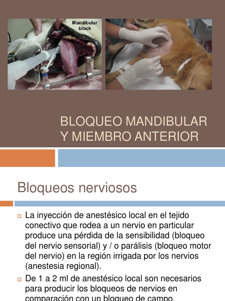 Bloqueo Mandibular y Miembro Anterior | PDF | Medicina | Salud y bienestar