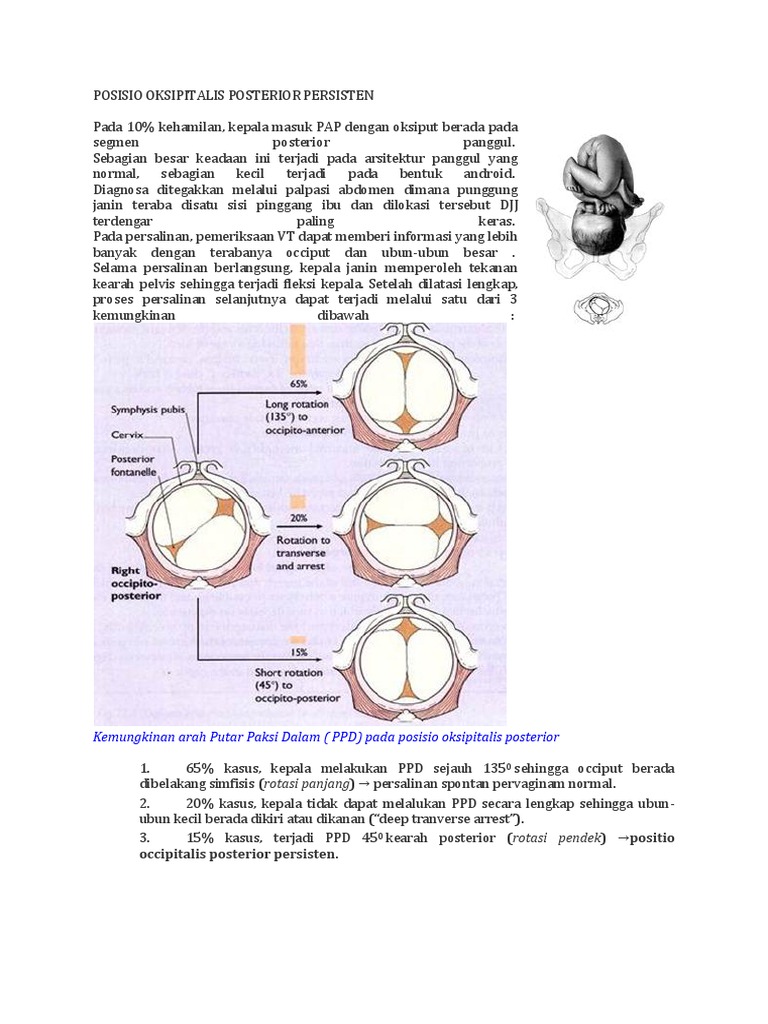 Posisio Oksipitalis Posterior Persisten | PDF