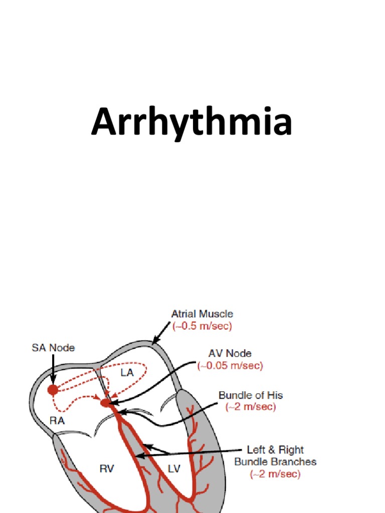 Arrhythmia | Cardiac Arrhythmia | Electrocardiography