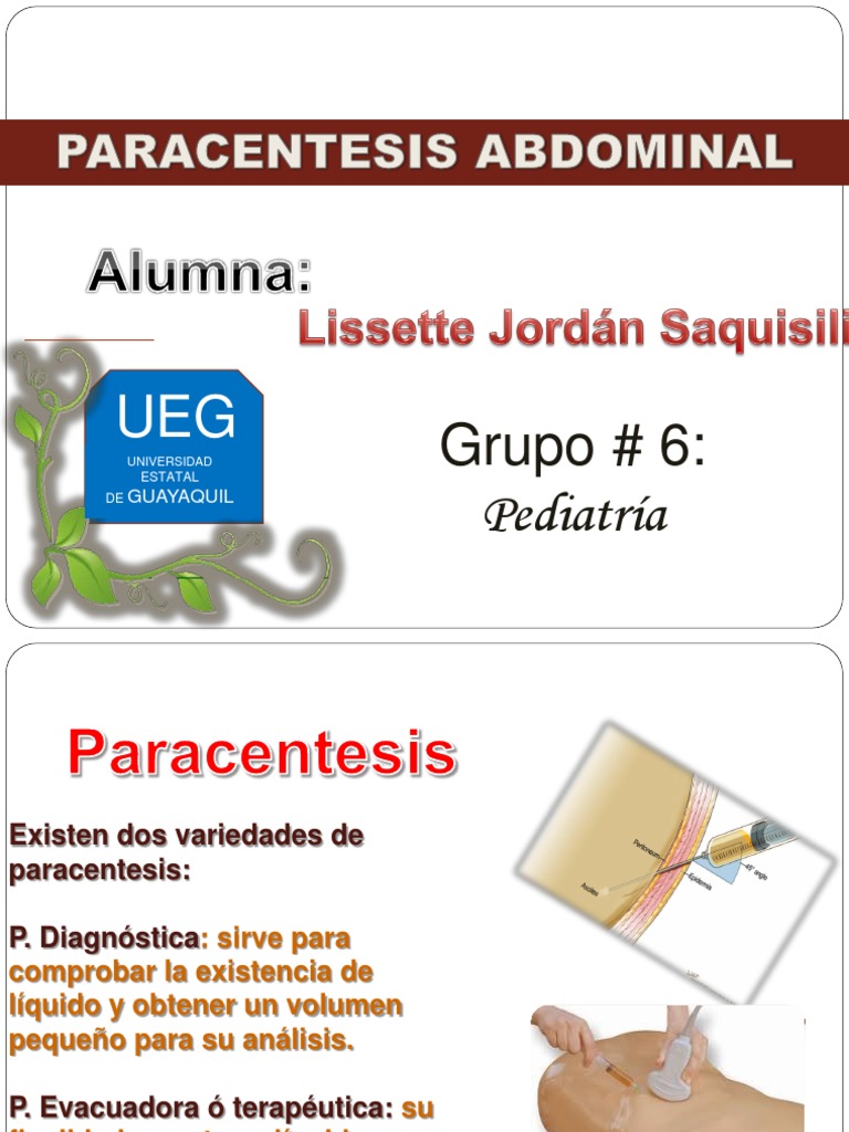 Paracentesis | PDF