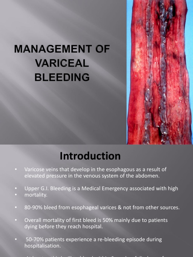 Variceal Bleeding FFH Med-2 | PDF | Cirrhosis | Esophagus
