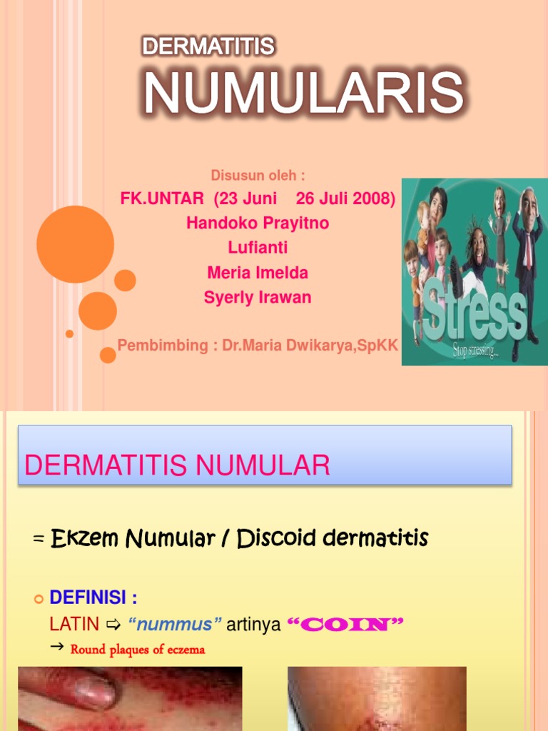 Dermatitis Numularis | PDF