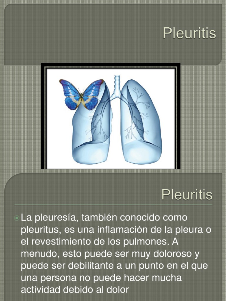 pleuritis | Especialidades Medicas | Medicina CLINICA | Prueba gratuita ...