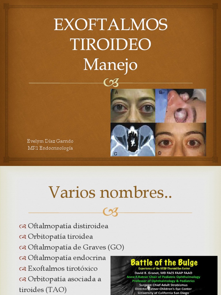 Exoftalmos Tiroideo | PDF | Tiroides | Órgano (anatomía)
