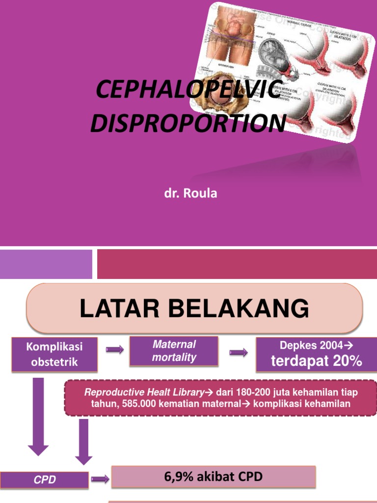 Cephalopelvic Disproportion: Dr. Roula | PDF | Memasak, Makanan ...