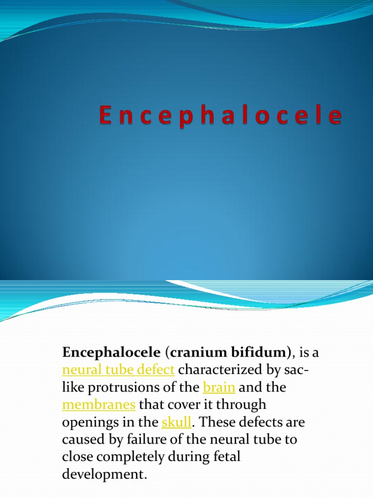 Neural Tube Defects: An Overview of Encephaloceles Including Causes ...