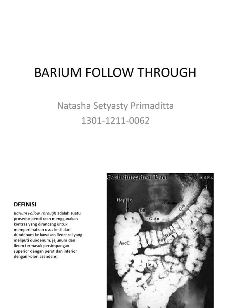 CSS - Barium Follow Through | PDF