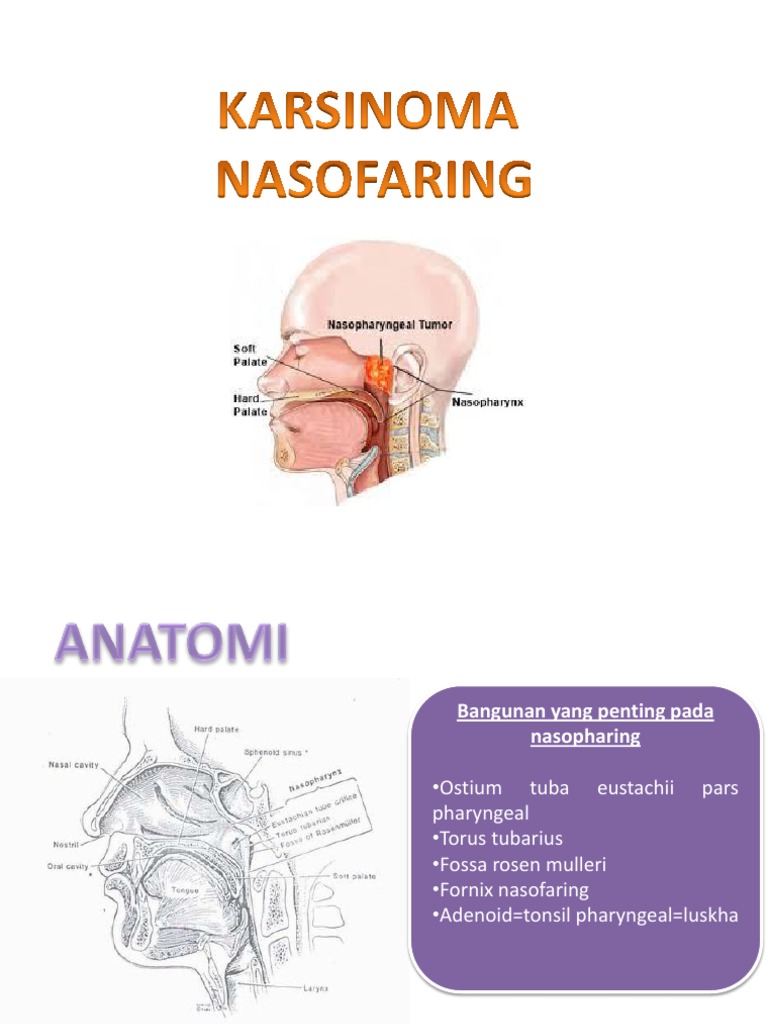 PENDEK_CA_NASOFARING | PDF