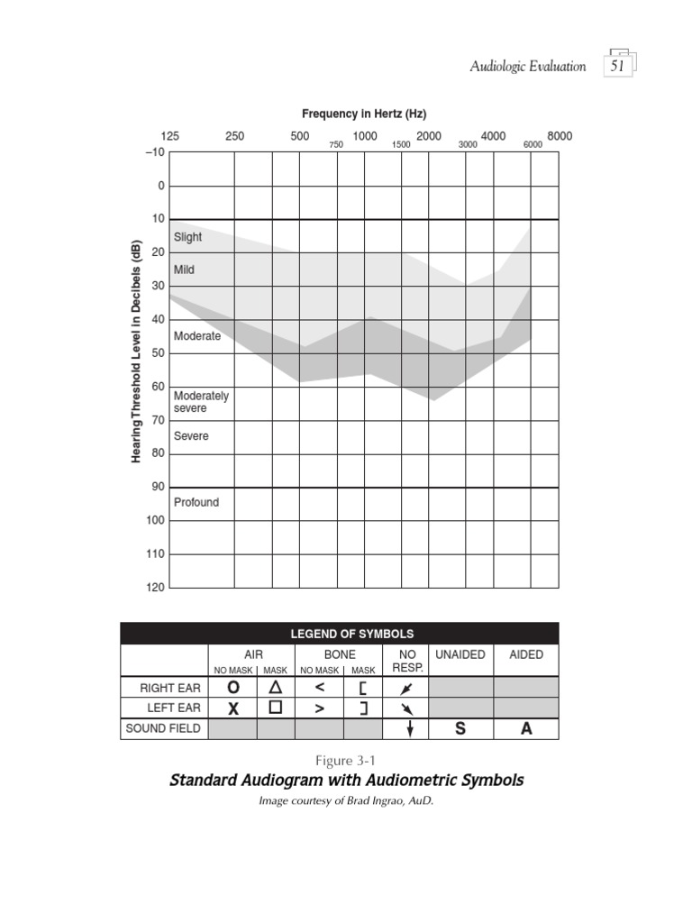 Audiologic Evaluation 51: Standard Audiogram With Audiometric Symbols | PDF