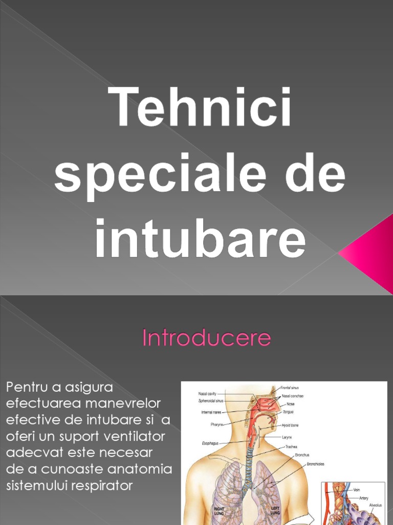 intubare