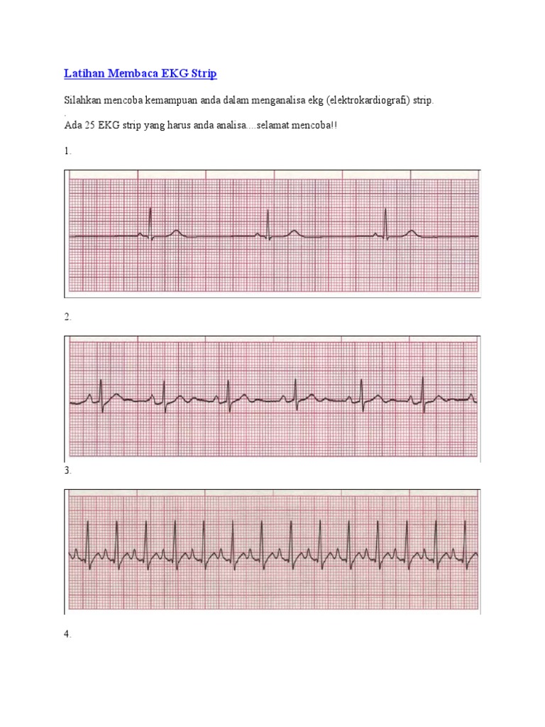 Latihan Membaca EKG | PDF | Metode & Bahan Ajar