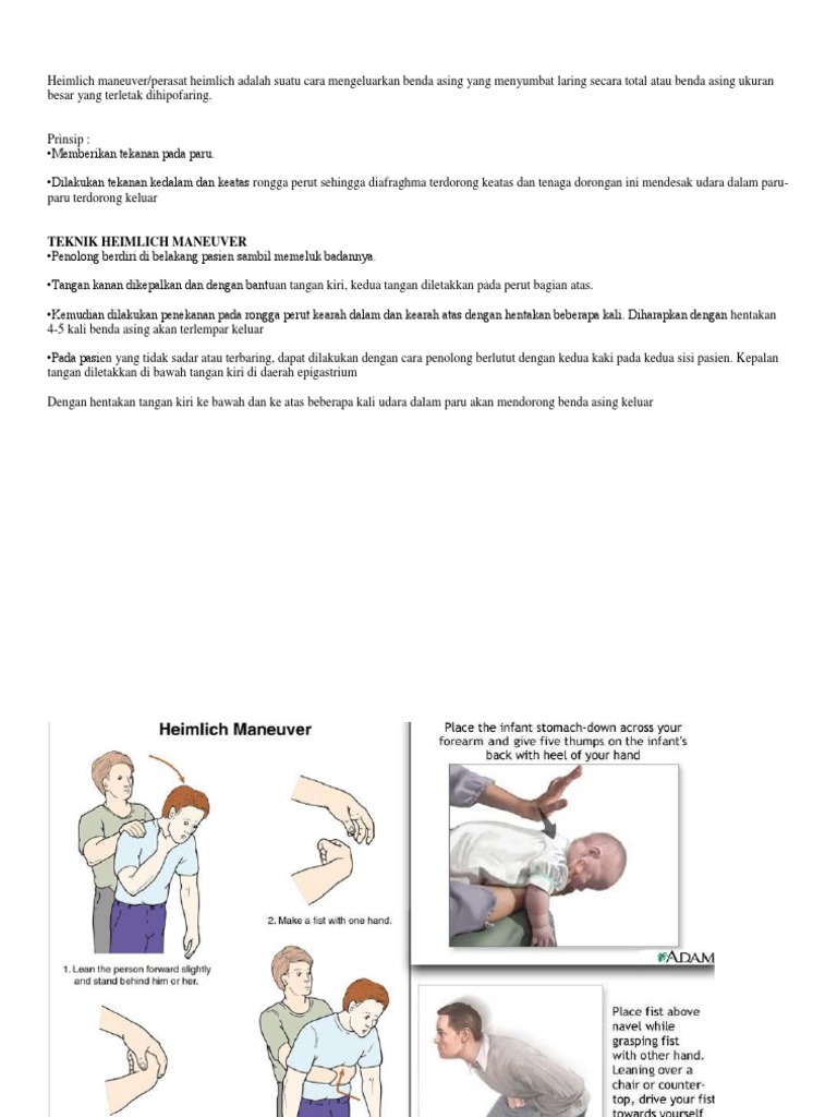 Heimlich Maneuver | PDF