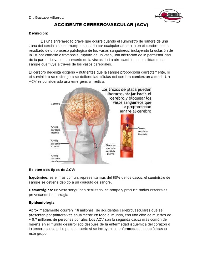 Accidente Cerebrovascular Tipos Y Epidemiología Pdf Embolia Carrera