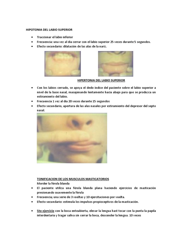 Hipotonia Del Labio Superior | Anatomía humana | Bienestar