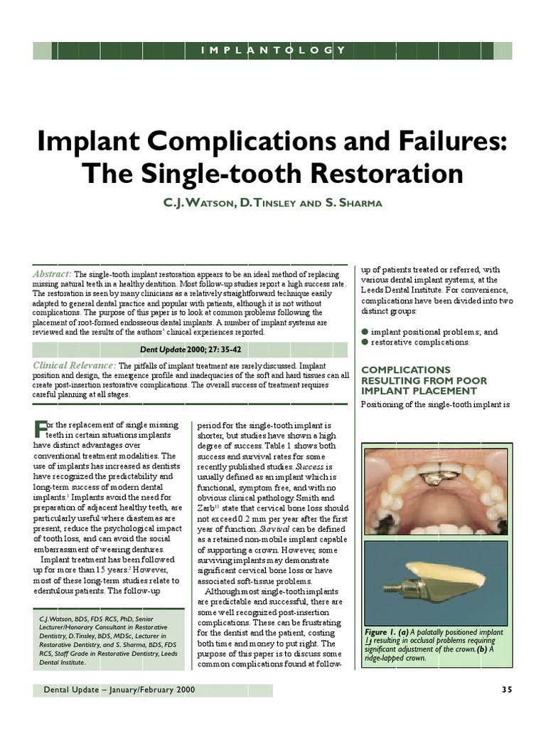 The Single-Tooth Restoration | PDF | Dental Implant | Dentistry Branches