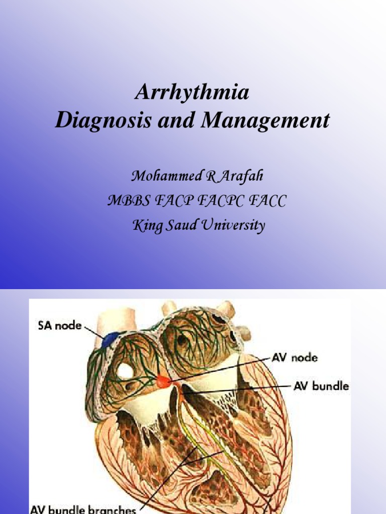 Arrhythmia Diagnosis and Management Guide | PDF