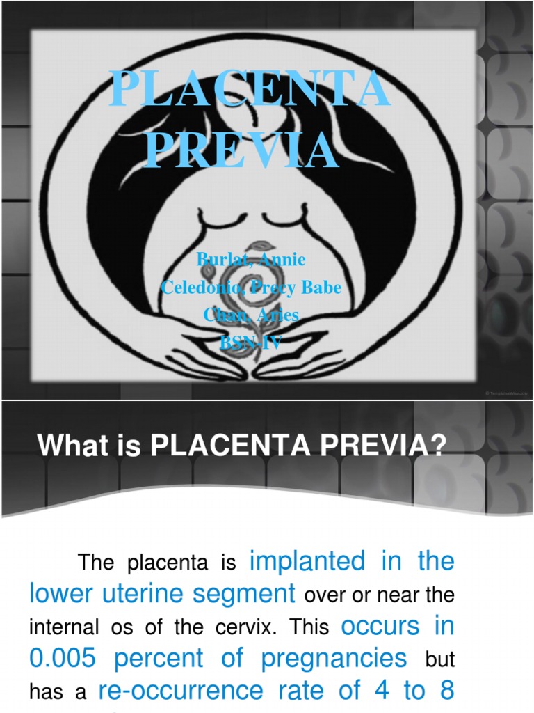 Placenta Previa.ppt | Placenta | Fetus