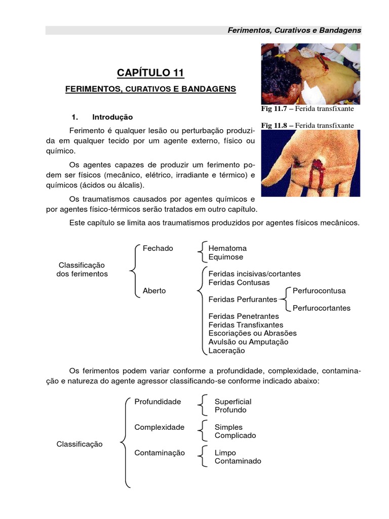 Capítulo 11 - Ferimentos, Curativos e Bandagens | PDF | Sangramento | Pele