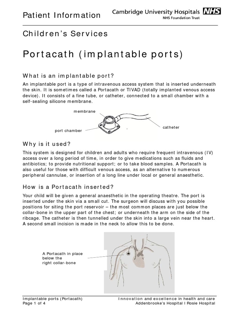 PIN2428 Implantable Ports Portacath | PDF | Intravenous Therapy ...