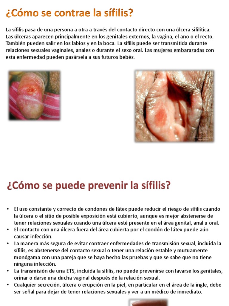 Sífilis En Mujeres Síntomas Y Prevención Pdf Infección Transmitida