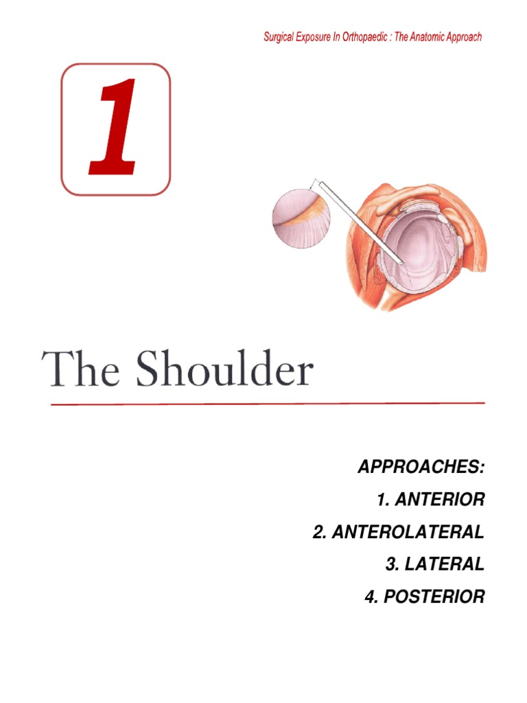 Approaches: 1. Anterior 2. Anterolateral 3. Lateral 4. Posterior | PDF ...