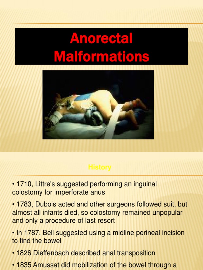 Atresia Ani Pada Anak | PDF | Congenital Disorder | Medical Specialties