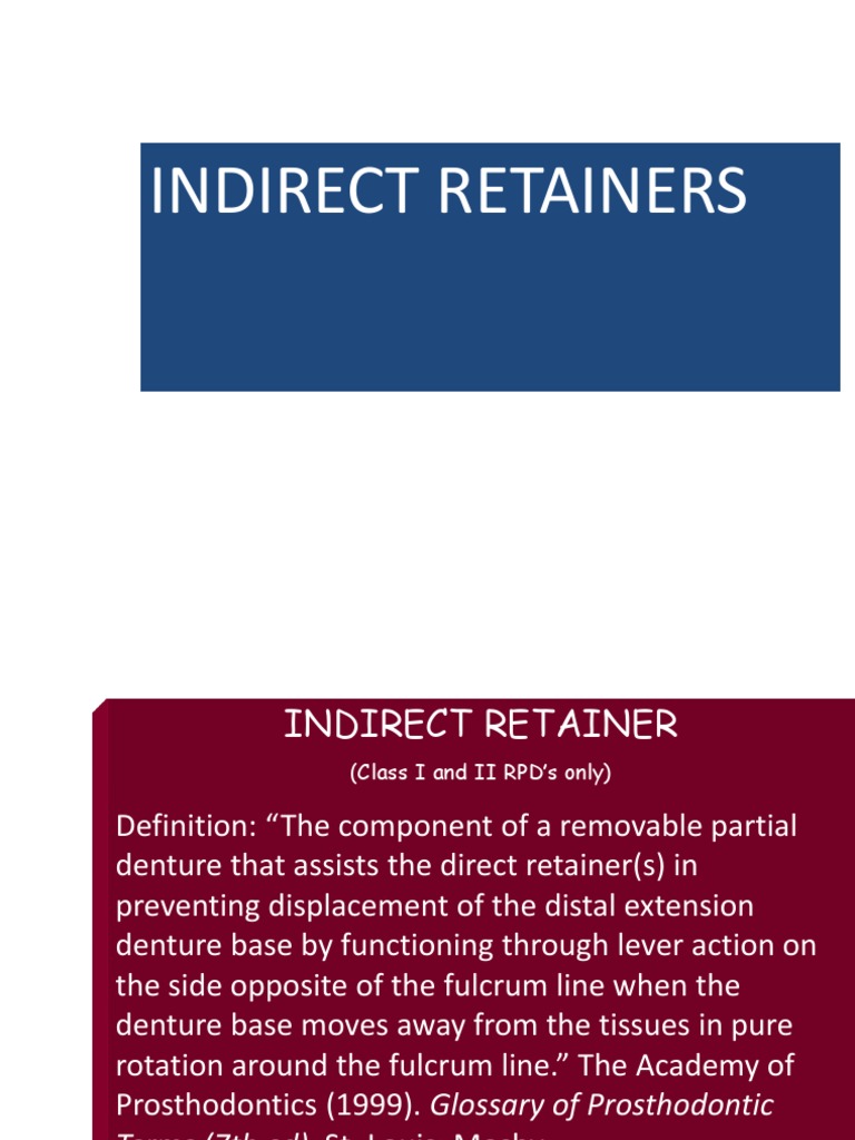 indirect retainers | Dentures | Dentistry