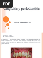 Etapas y Grados de Caries PDF | PDF | Diente | Odontología