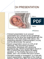 Case Study On Breech Birth | PDF | Maternal Death | Childbirth