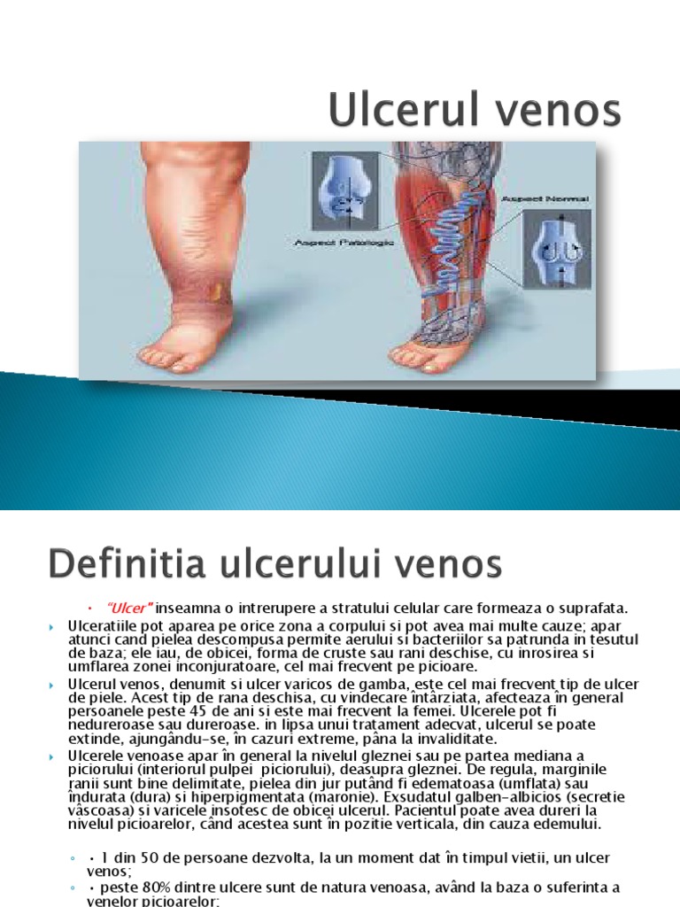 Ulcerul Venos | PDF