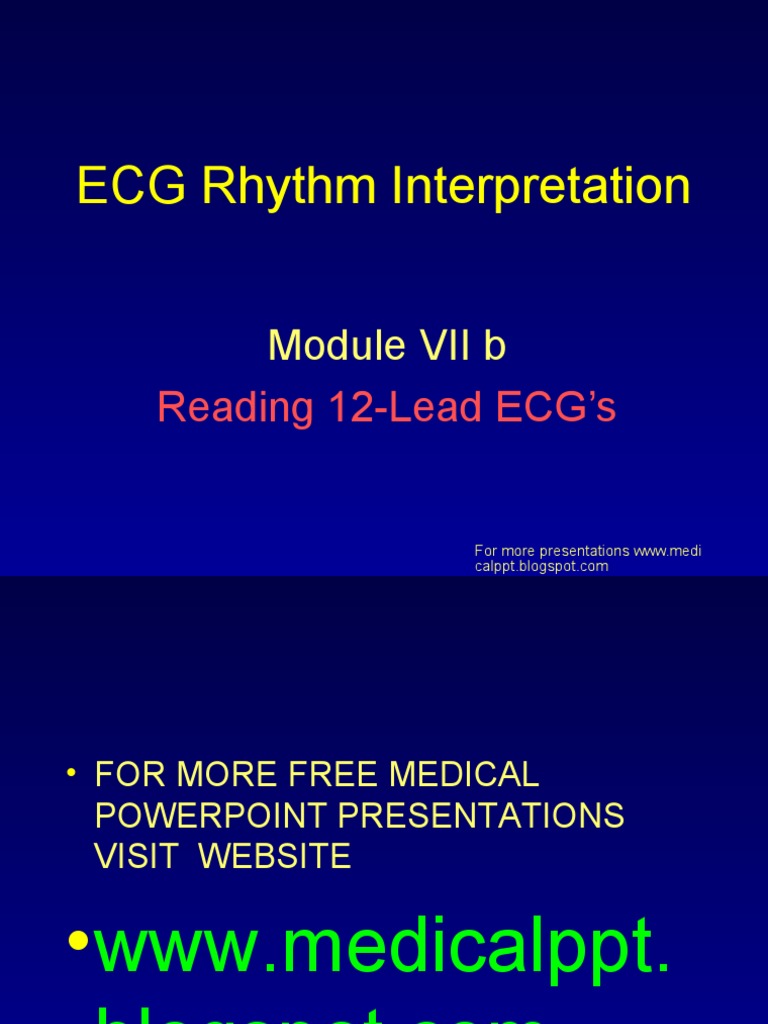 ECG Rhythm Interpretation: Reading 12-Lead ECG's | PDF ...