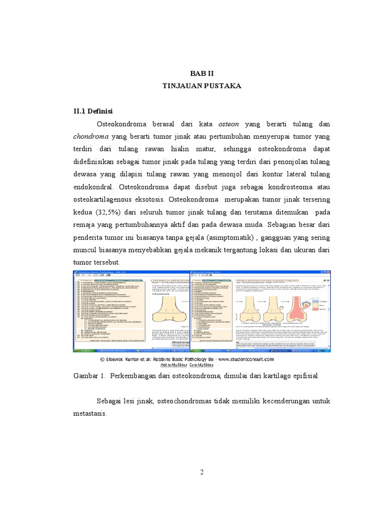 Osteokondroma | PDF