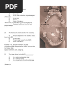 Prostho MCQ | PDF | Dentures | Dental Implant