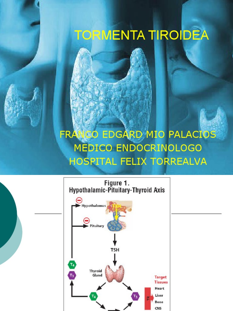 TORMENTA TIROIDEA, Dr. Franco Mio Palacios | Tiroides | Hipertiroidismo