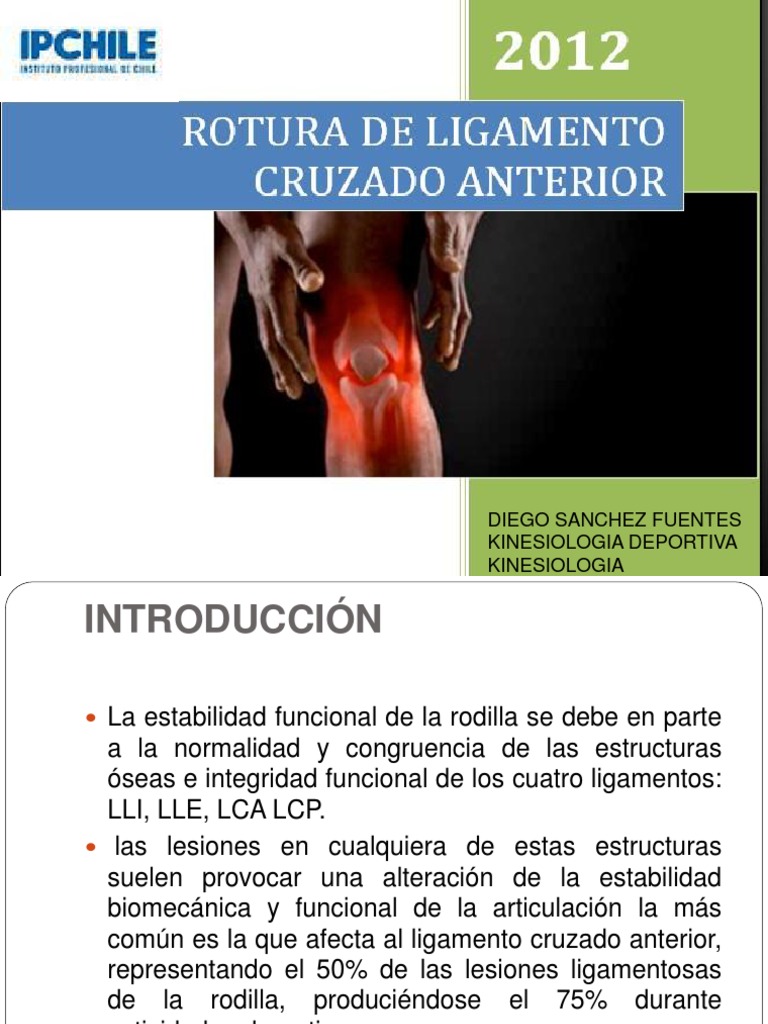 Lesiones del Ligamento Cruzado Anterior | PDF | Rodilla | Sistema ...