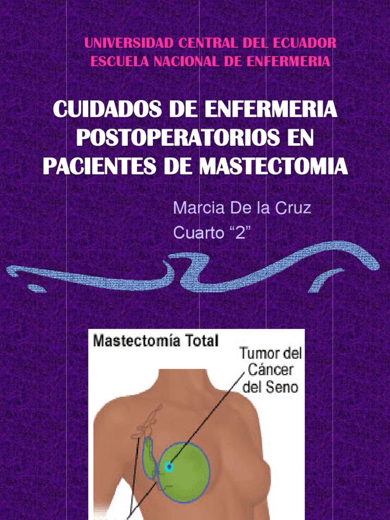 Mast Ecto Mia | PDF | Herida | Pecho