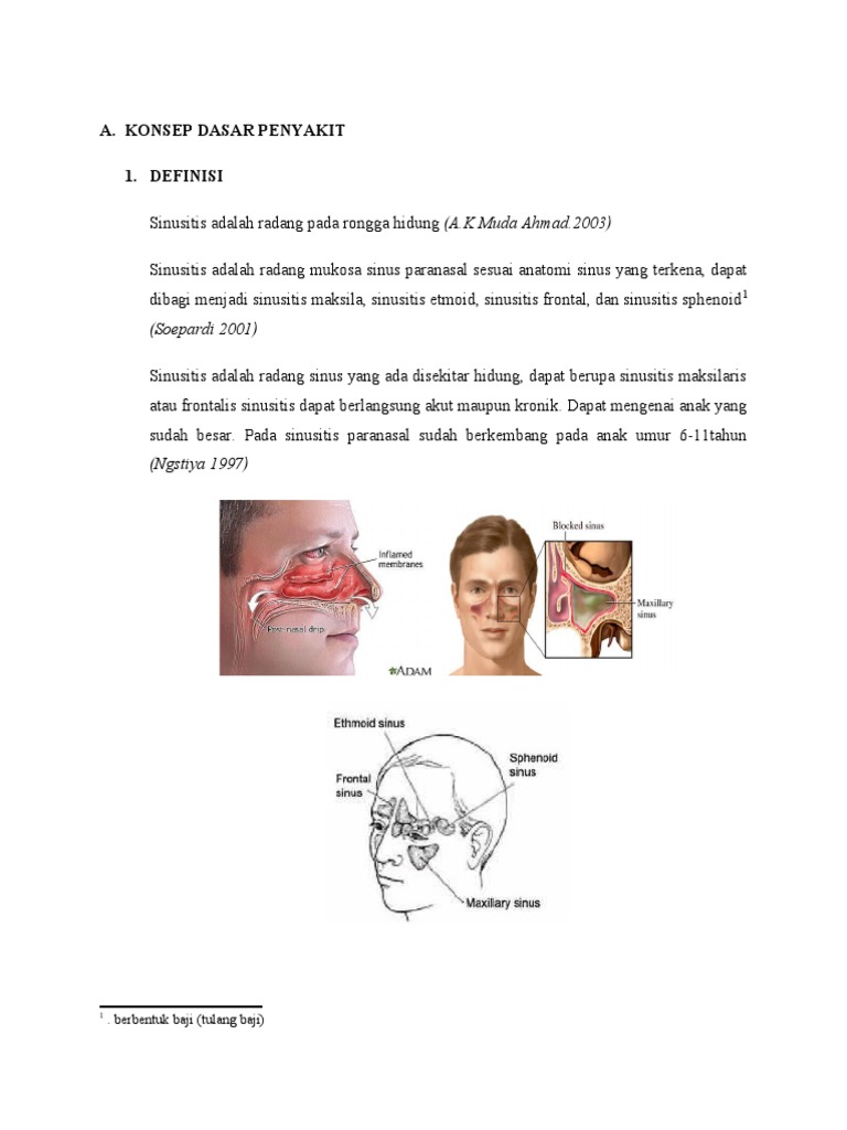 Askep Sinusitis | PDF