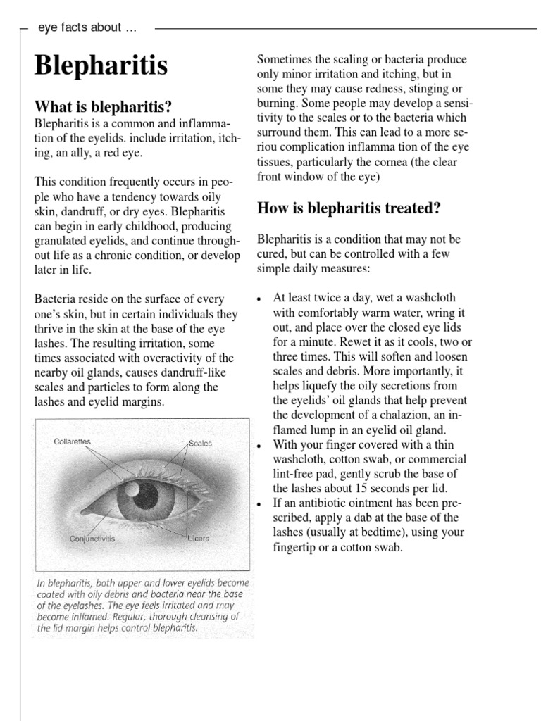 Blepharitis | Public Health | Immunology