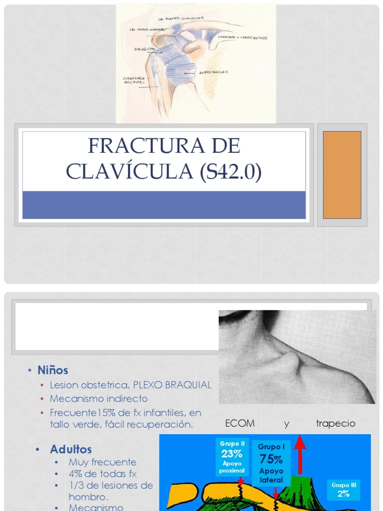 Fracturas de Clavícula y Antebrazo: Guía Clínica | PDF | Extremidades ...