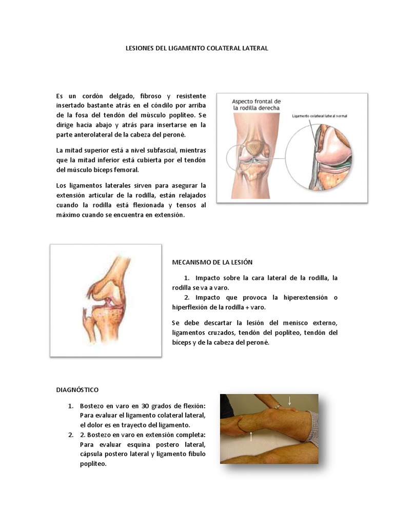 Lesiones Del Ligamento Colateral Lateral | PDF | Rodilla | Articulaciones
