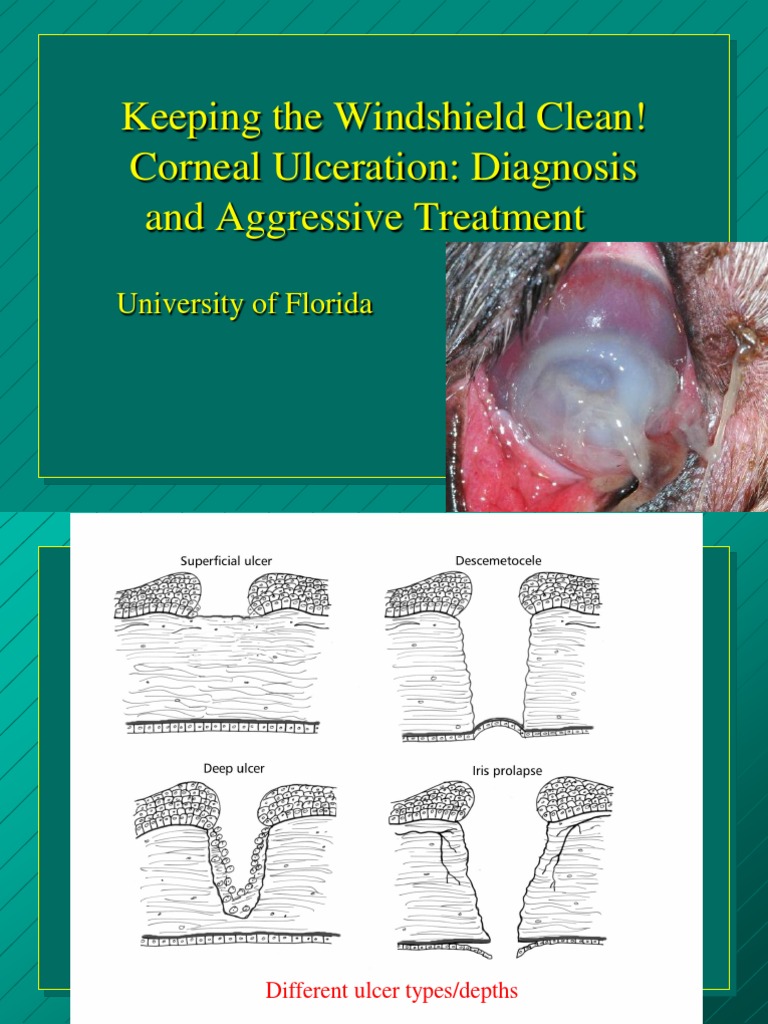 SA Corneal Ulcers | Cornea | Ophthalmology