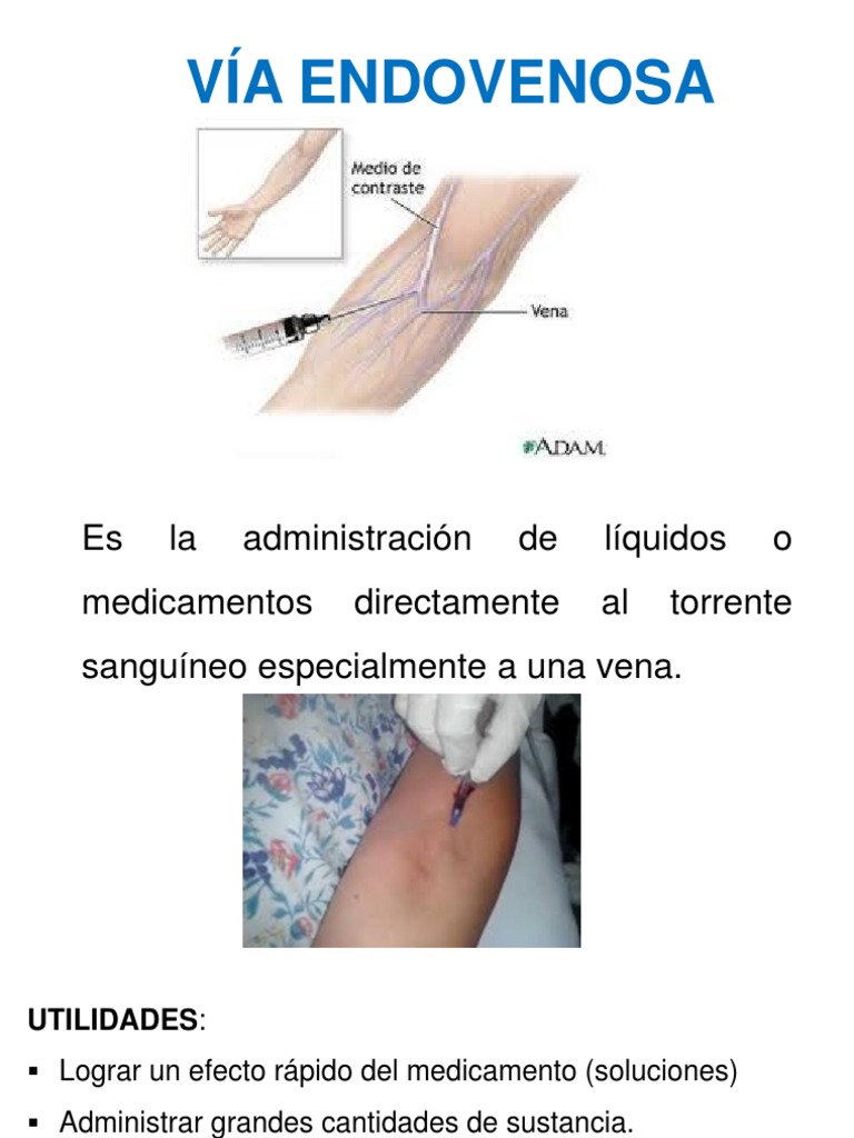 Administración endovenosa: Procedimiento, zonas de aplicación, ventajas ...