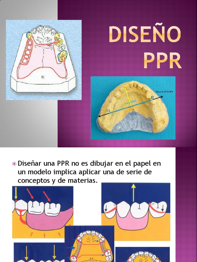 Diseño de PPR: Guía Práctica | PDF | Boca | Naturaleza