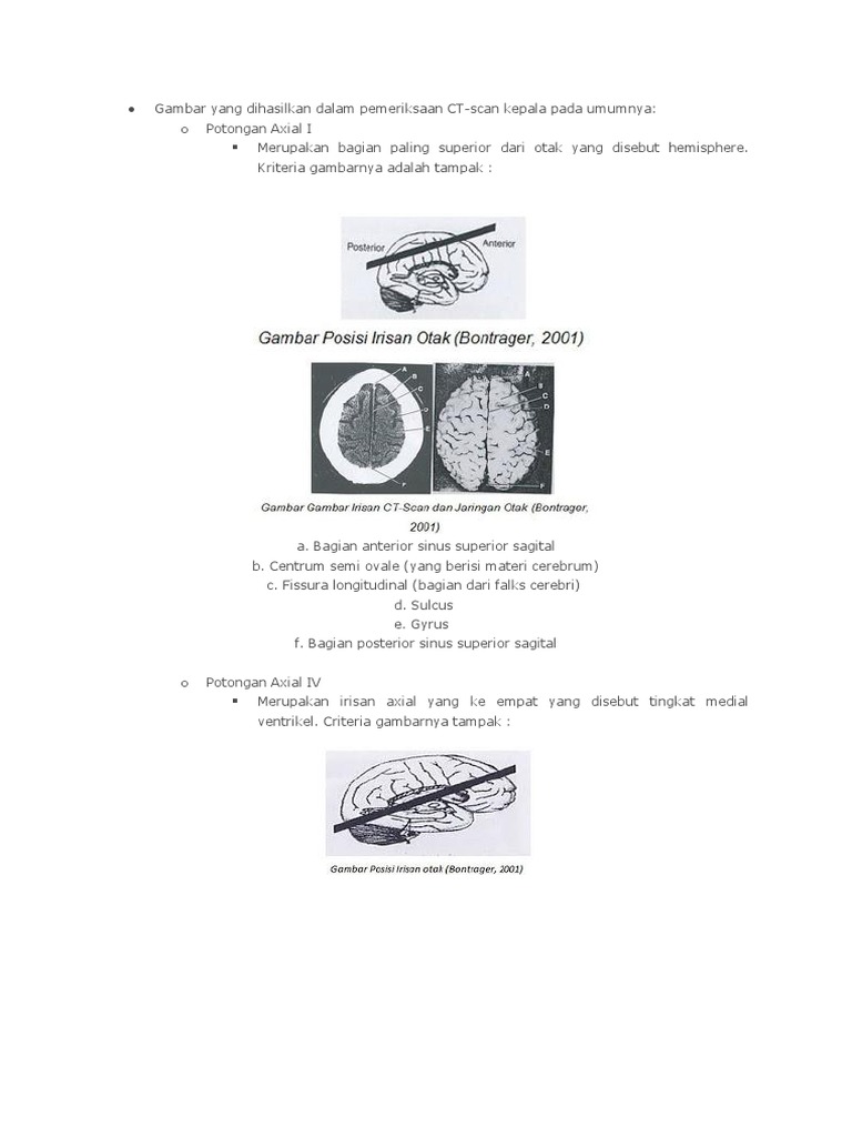 Bagian-Bagian Kepala Berdasarkan Potongan Axial CT Scan | PDF