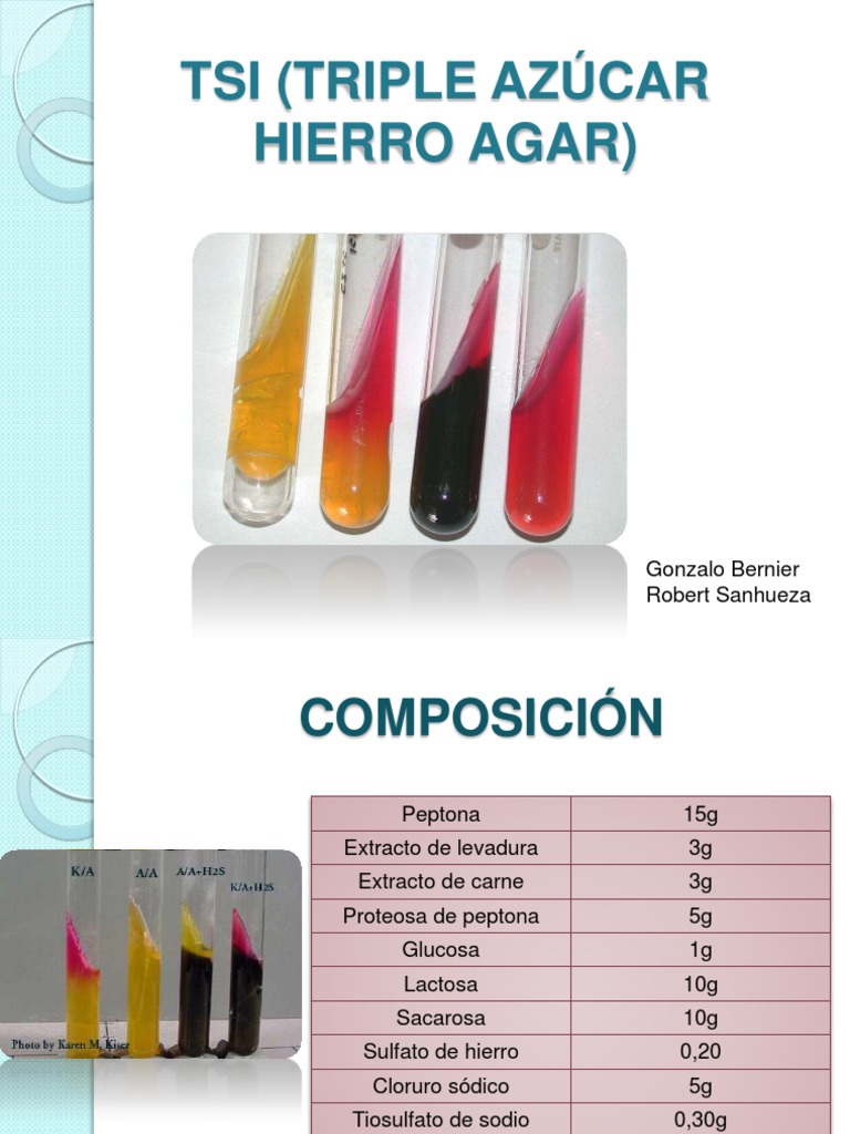 Prueba Tsi Microbiología