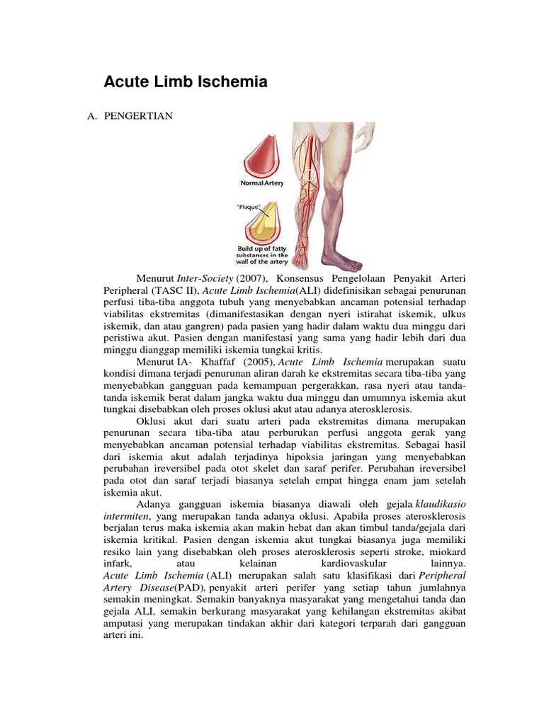 Acute Limb Ischemia | PDF