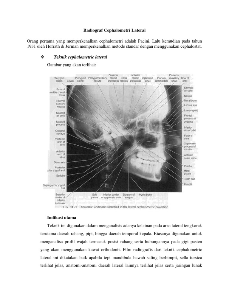 Radiograf Cephalometri Lateral | PDF