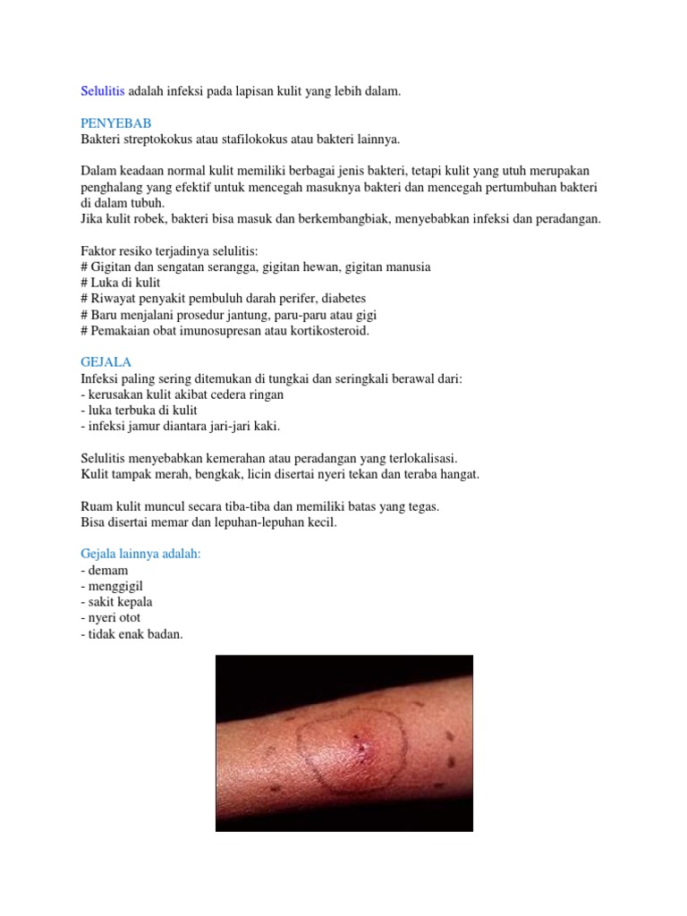 Selulitis, DM | PDF