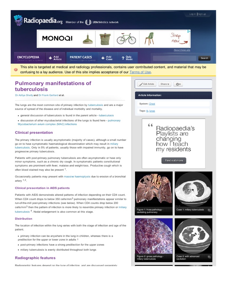 Tuberkulozi | PDF | Tuberculosis | Lung