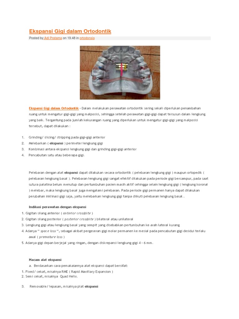Ekspansi Gigi Dalam Ortodontik | PDF